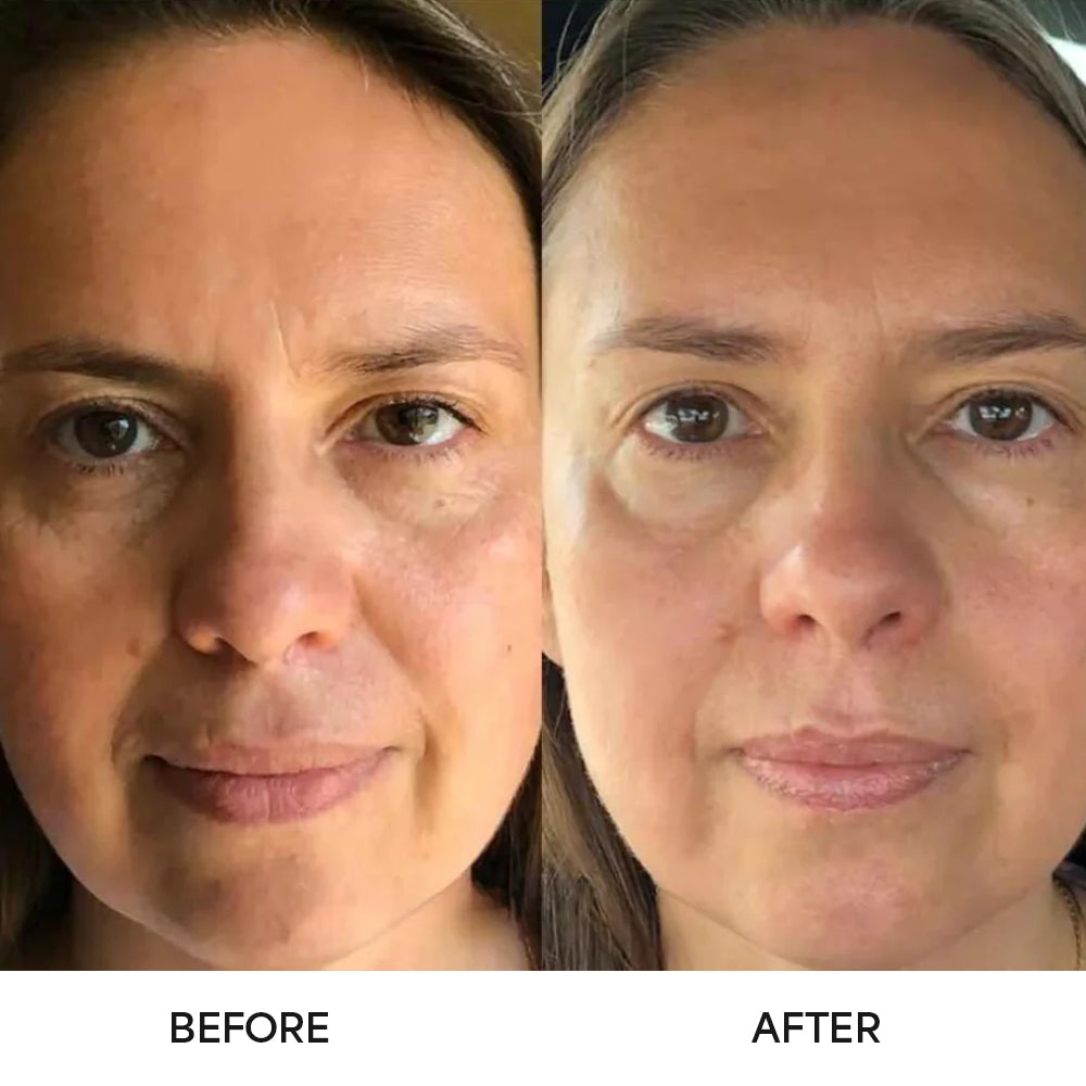 Dermave™ Light Therapy Face Massager