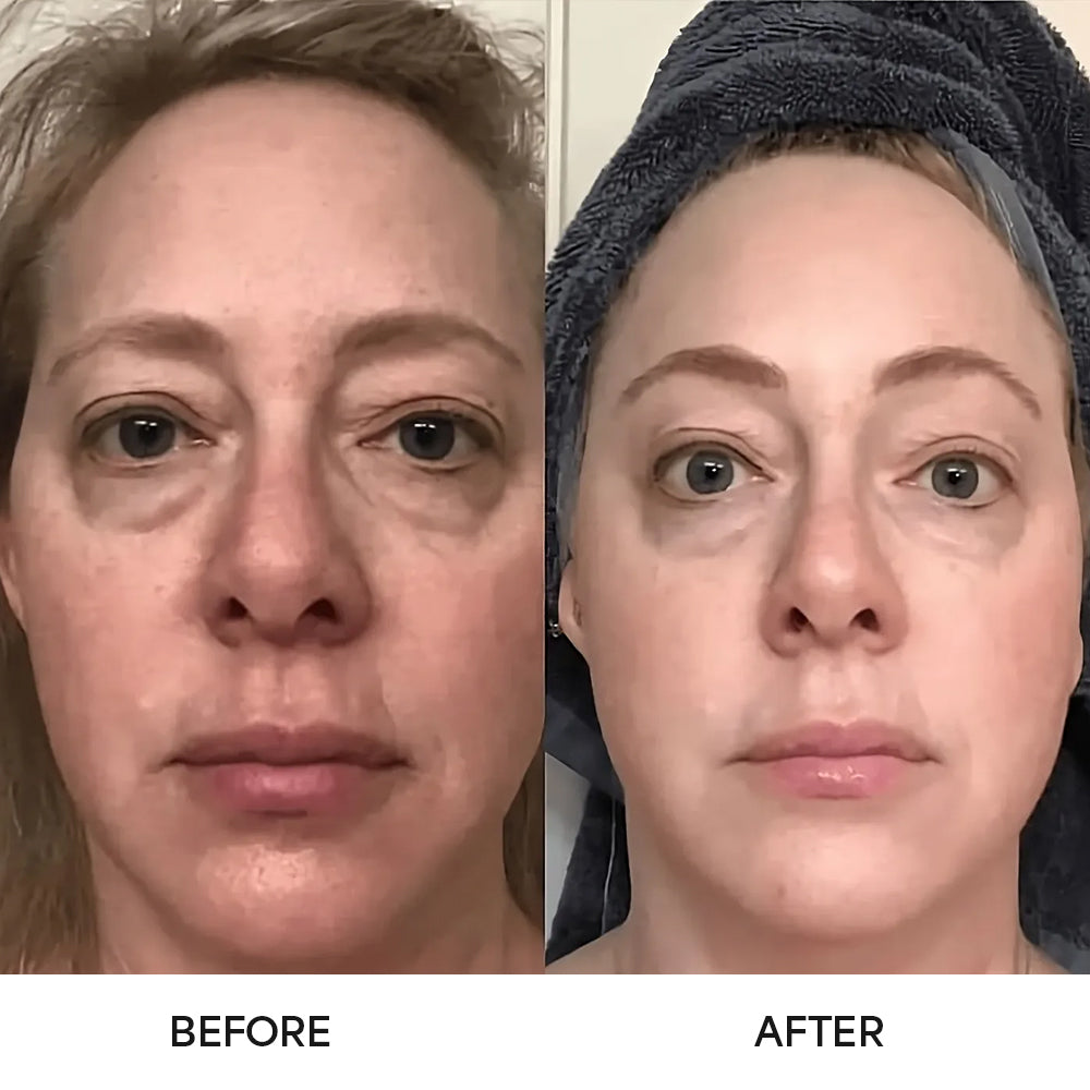 Dermave™ Light Therapy Face Massager