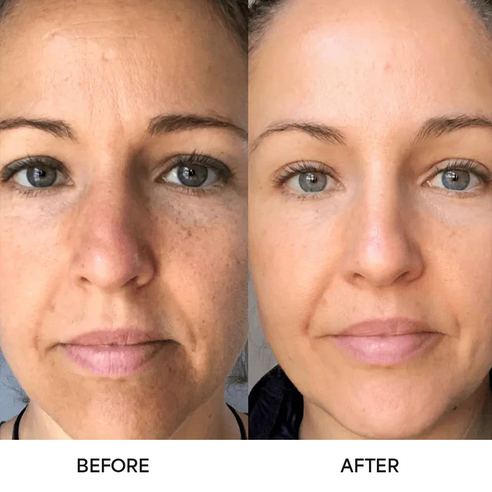 Dermave™ Light Therapy Face Massager