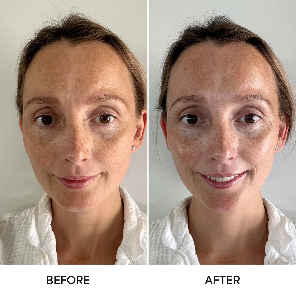 Dermave™ Light Therapy Face Massager