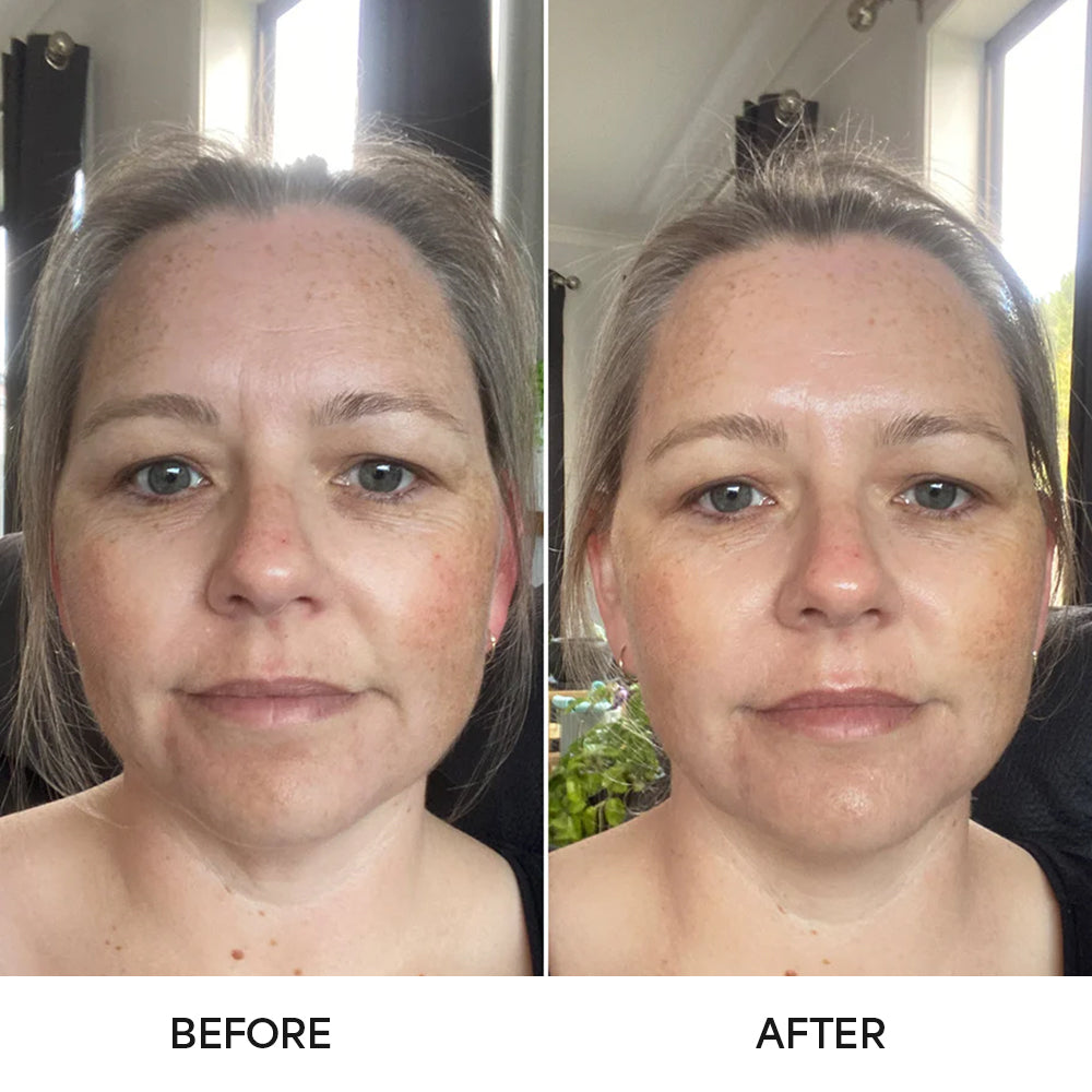 Dermave™ Light Therapy Face Massager